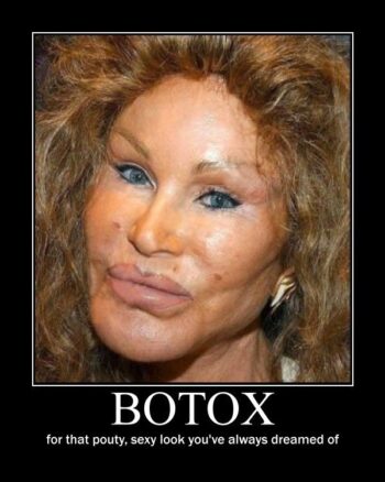 20 Hilarious Botox Memes That Show What Happens When It Kicks In ...