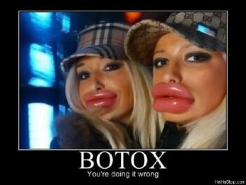 20 Hilarious Botox Memes That Show What Happens When It Kicks In ...